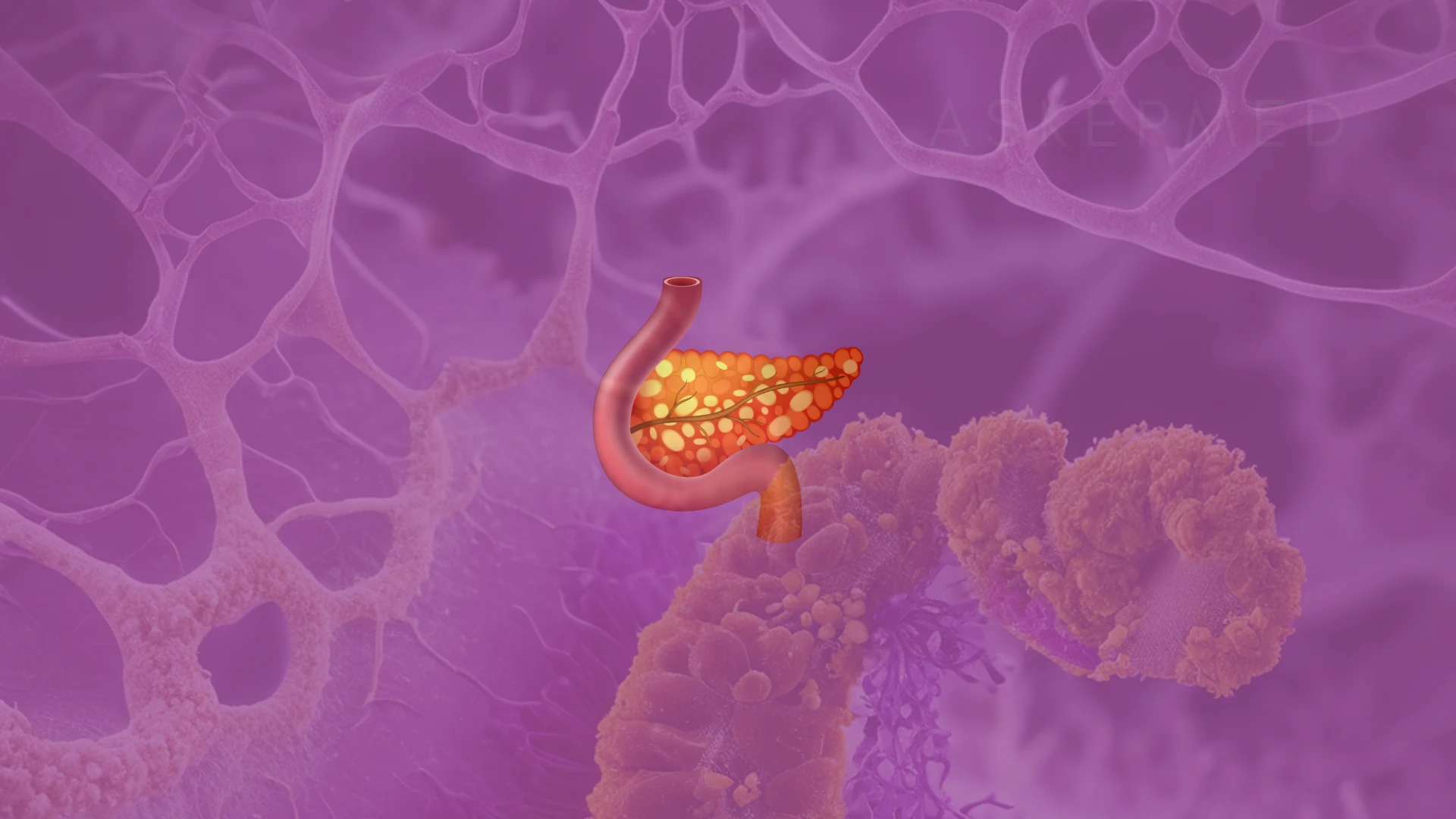 Kanker Pankreas Gejala Penanganan Dan Harapan Askep Med